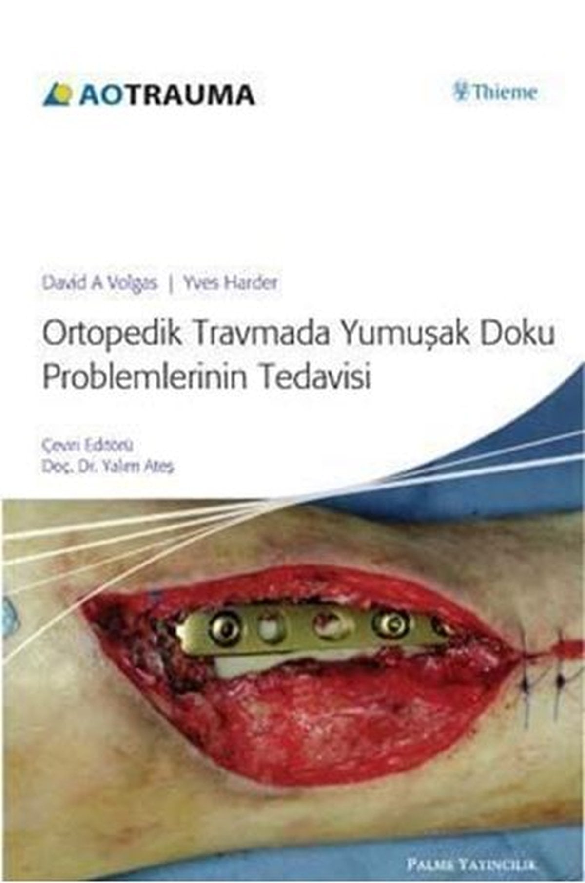 Ortopedik Travma Yumuşak Doku Problemlerinin Tedavisi - Agora Bilim Pazarı